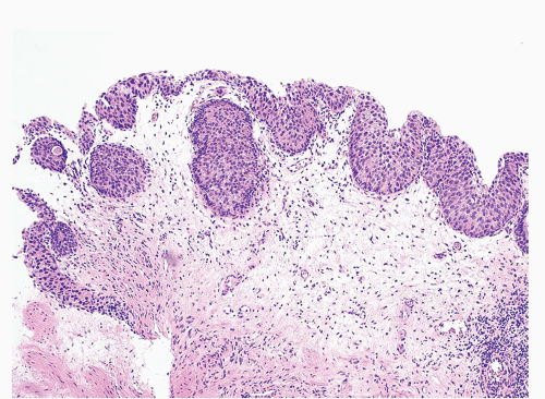 Bladder | Basicmedical Key