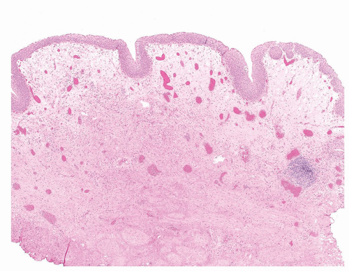 Bladder | Basicmedical Key
