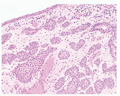Bladder | Basicmedical Key