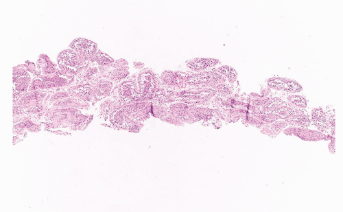 Testis | Basicmedical Key