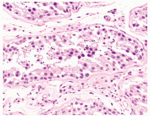 Testis | Basicmedical Key