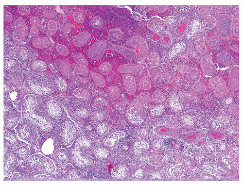 Testis | Basicmedical Key