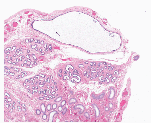 Paratestis and External Genitalia | Basicmedical Key