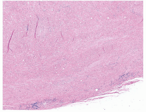 Paratestis and External Genitalia | Basicmedical Key