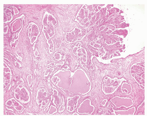 Paratestis and External Genitalia | Basicmedical Key