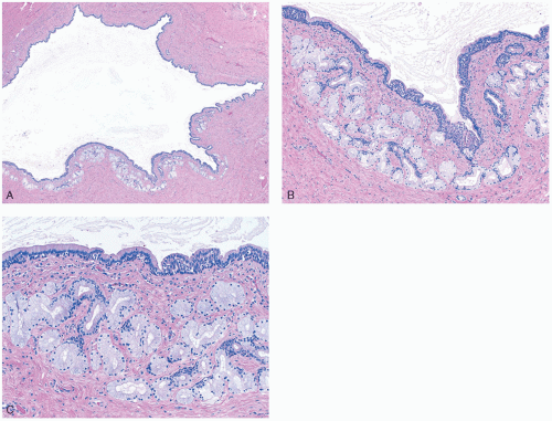 Vagina | Basicmedical Key
