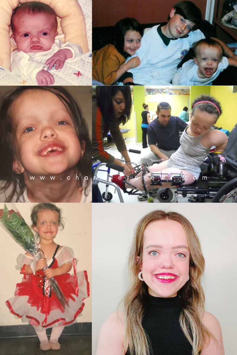 What Matters to Me - Achondroplasia What Matters to Me Chandler C. Crews