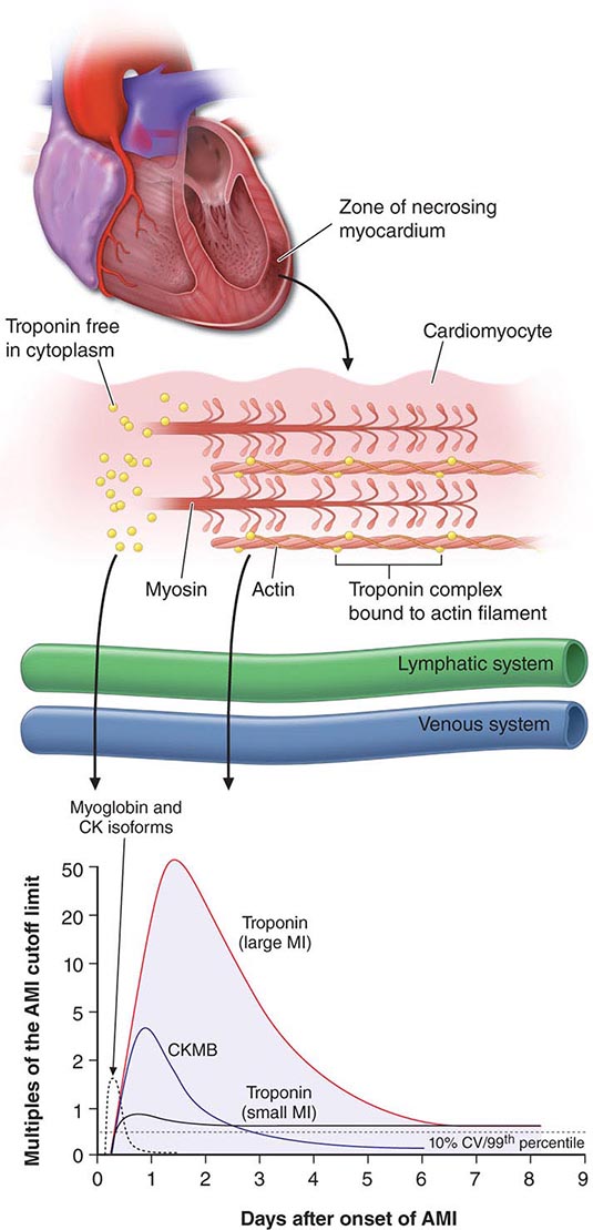cardiac-manifestations-of-systemic-disease-clinical-gate