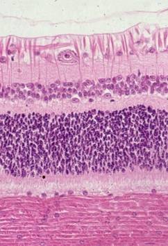 A Clinical Case from the Archives : 03/01/2011 | Veterinary ophthalmology