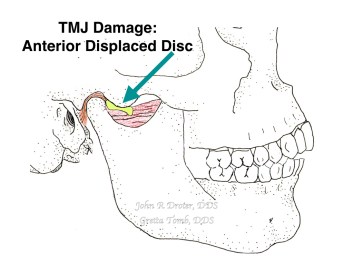 John R. Droter, DDS | Facial Pain Diagnosis and TMJ Rehabilitation
