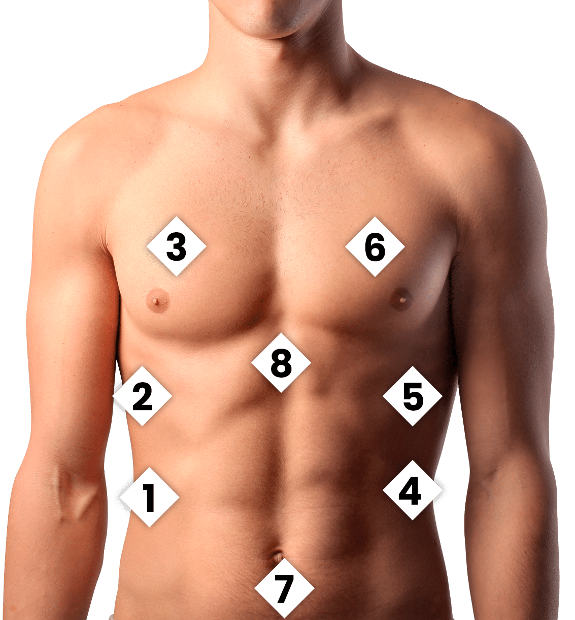 Protocolo EFAST: entenda melhor como usá-lo na emergência - Educa Cetrus