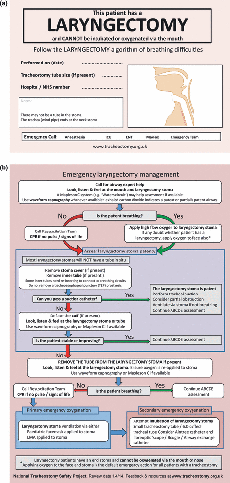 Podcast 195 - Management of Tracheostomy (Trach) and Laryngectomy ...