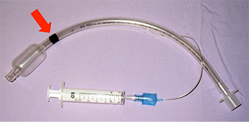 PulmCrit- Devil in the details: Endotracheal tube depth