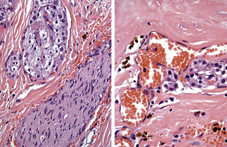 Head and Neck Pathology | Ento Key