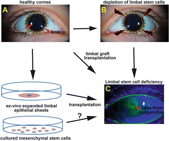 Corneal Stem Cells: A Source of Cell Renewal with Therapeutic Potential ...