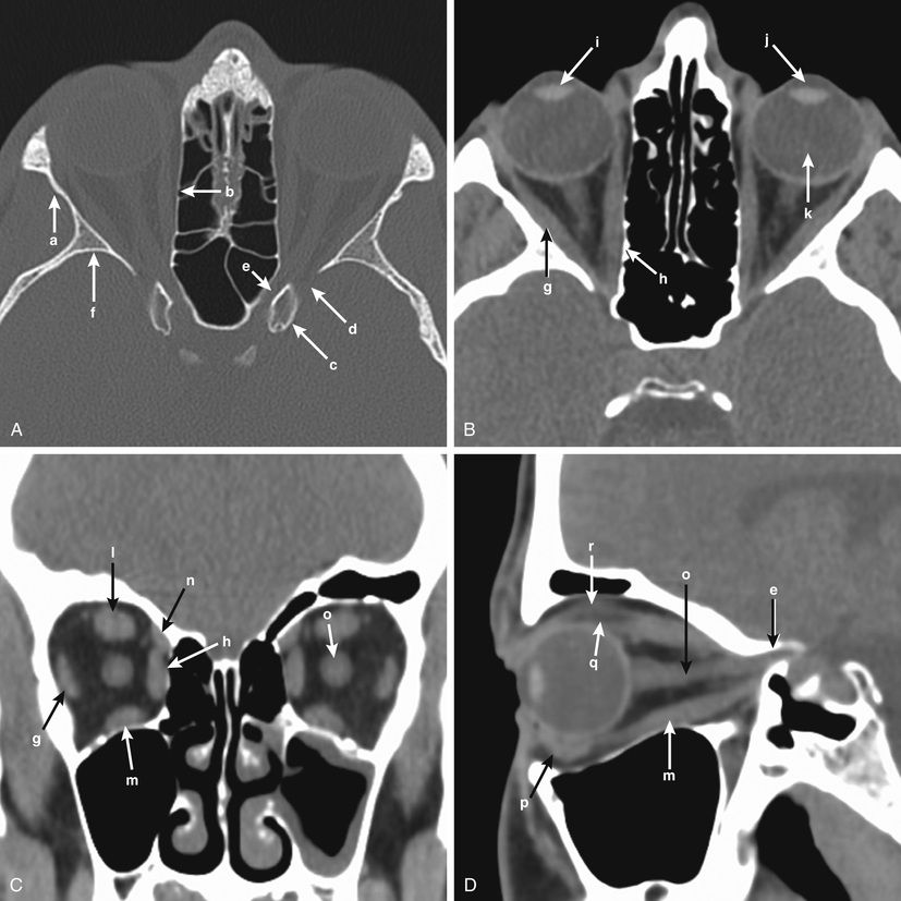 Imaging Modalities | Ento Key