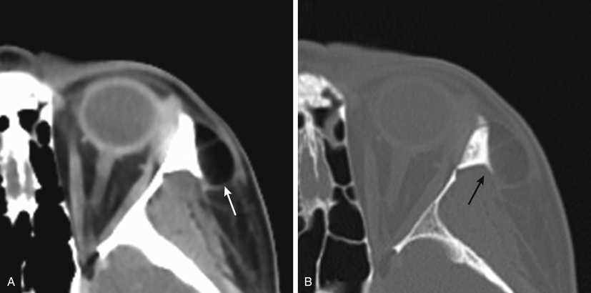 Imaging Modalities | Ento Key