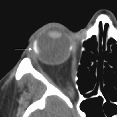 Imaging Modalities | Ento Key