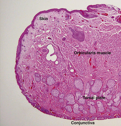 Pathology | Ento Key