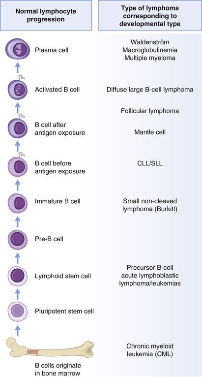 Lymphoproliferative Disorders | Ento Key