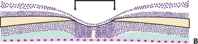 Normal Anatomy of the Macula | Ento Key