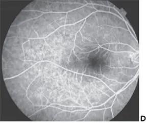 Normal Anatomy of the Macula | Ento Key