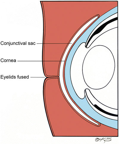 Embryology and Anatomy of the Developing Face | Ento Key