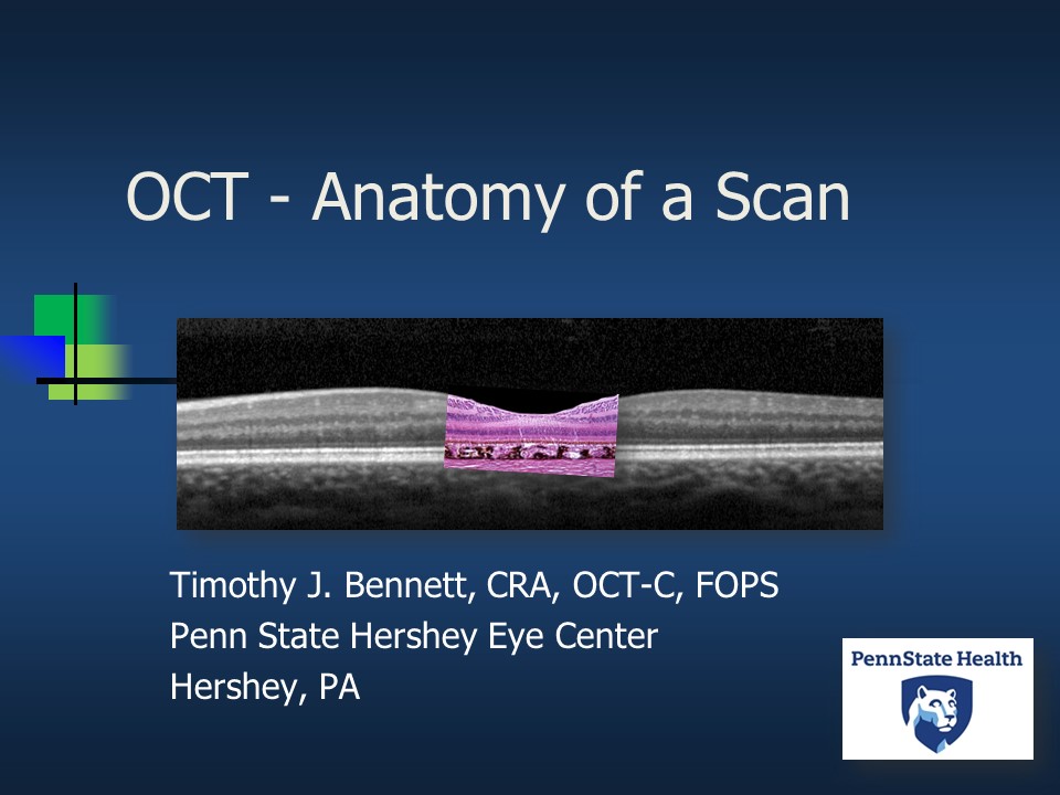 OCT: Anatomy of a Scan