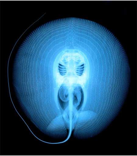 Mary’s Monday Metazoan: X-ray ray