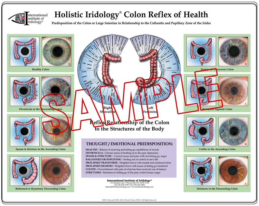 Charts « Dr. Pesek's Holistic Iridology