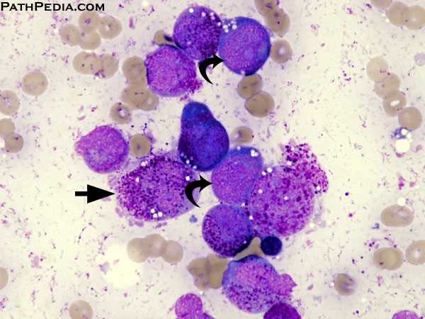 The Case of the Perplexing Crepitations – International Emergency ...