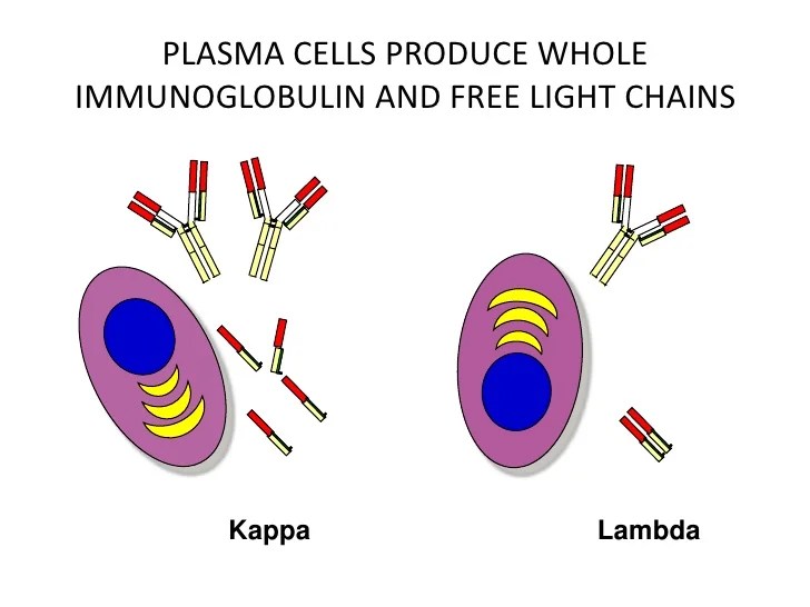 What Does A High Kappa Light Chain Value Mean what-does-a-high-kappa-light-chain-value-mean