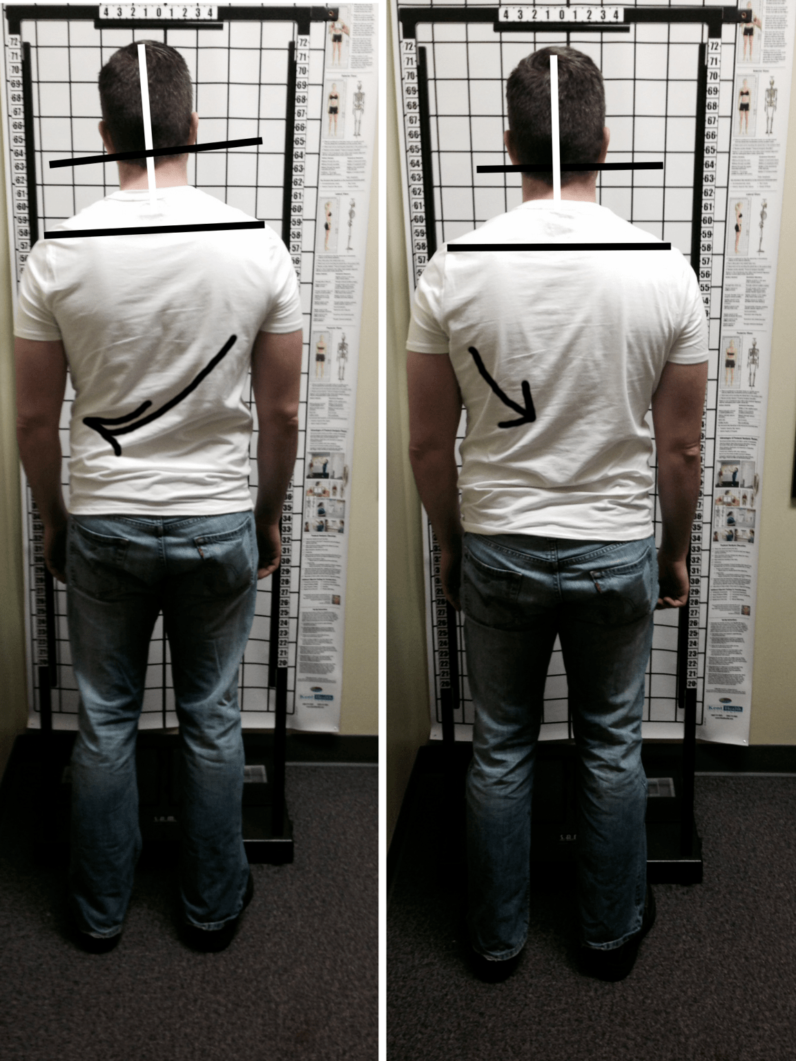 How to hold your spinal alignment - the three major chiropractic ...