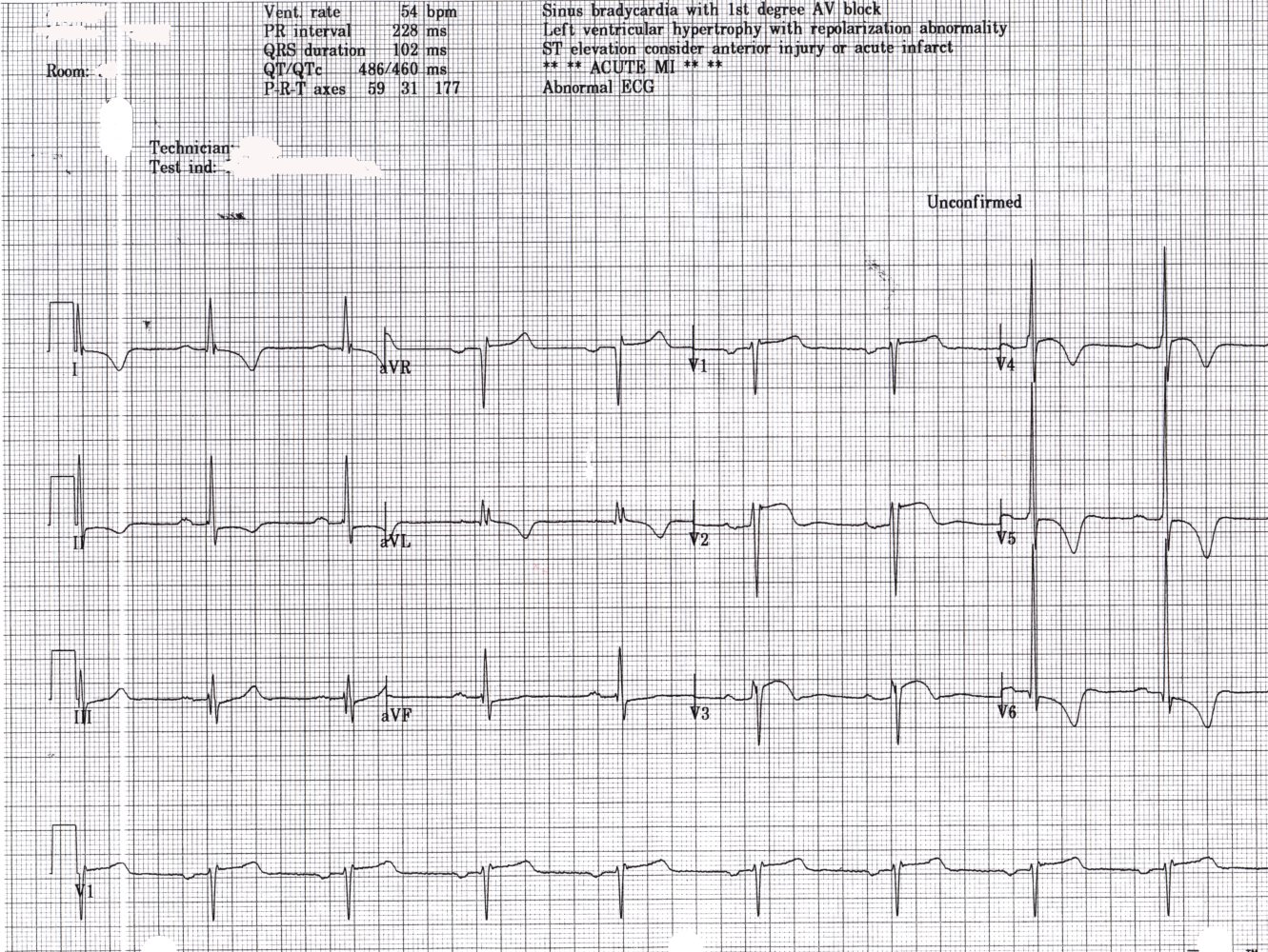 chest pain | Lost on the Floor
