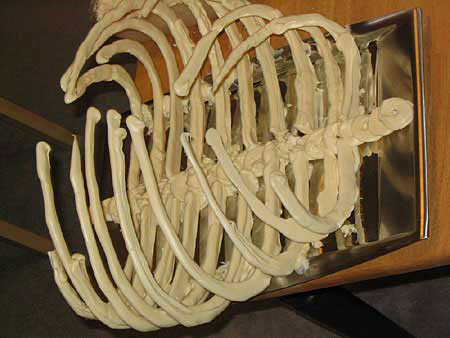 Tastey Intestines! Mmm, Thorax Cake r 4 d WINZ! People Bleed your Heart ...