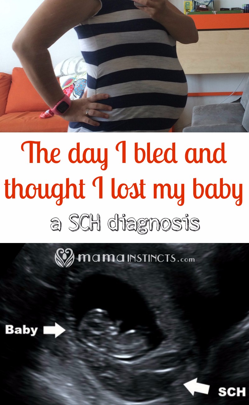 The Best Bleeding At 5 Weeks Pregnant With No Pain References Pregnant Education the-best-bleeding-at-5-weeks-pregnant-with-no-pain-references-pregnant-education