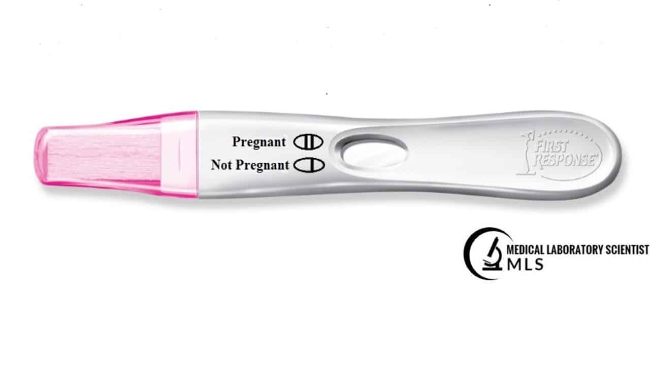 Pregnancy Test: Principle, Procedure, Requirements and Interpretation