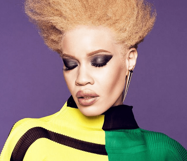 Meet the first model with albinism to front a major beauty campaign ...