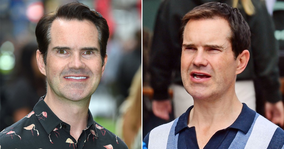 Jimmy Carr looking luscious after detailing hair transplant | Metro News