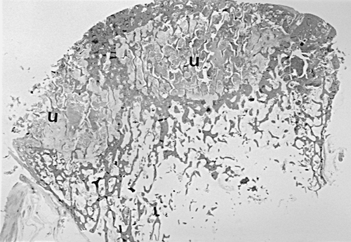 Pathology of Osteoarthritis | Musculoskeletal Key