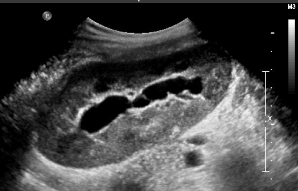 Image Gallery - NephSIM