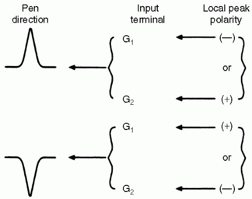 General Principles of Electroencephalography | Neupsy Key