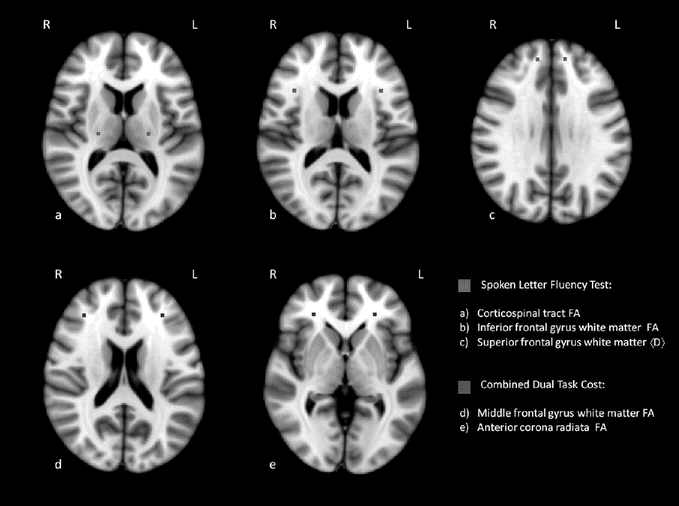 The FTD-ALS spectrum | Neupsy Key