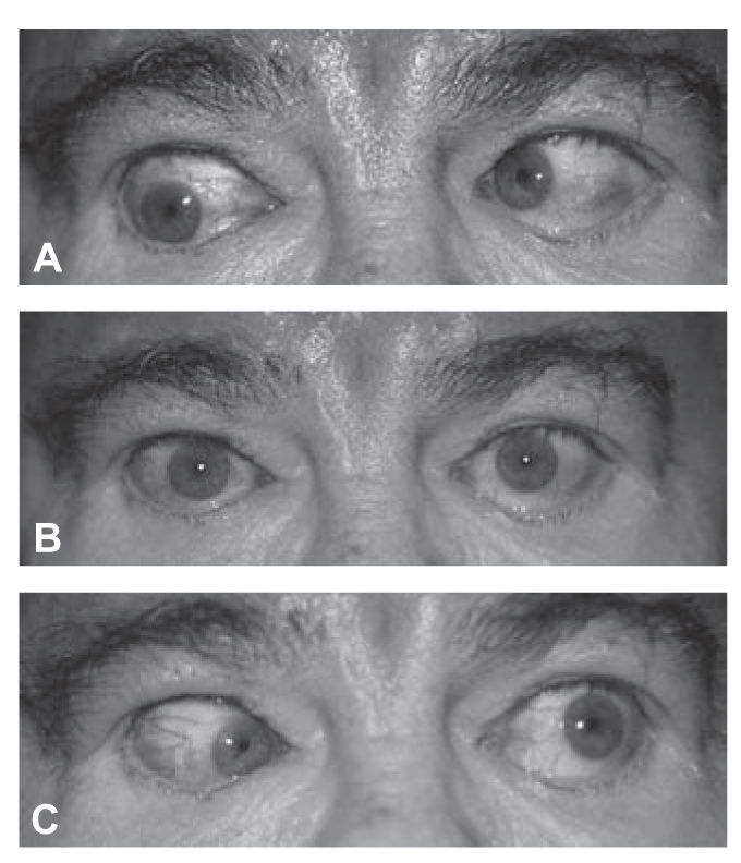 Approach to the Patient with Visual Loss | Neupsy Key