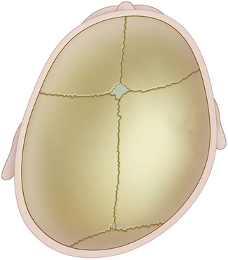 Evaluation of Head Shape in the Pediatric Practice: Plagiocephaly vs ...