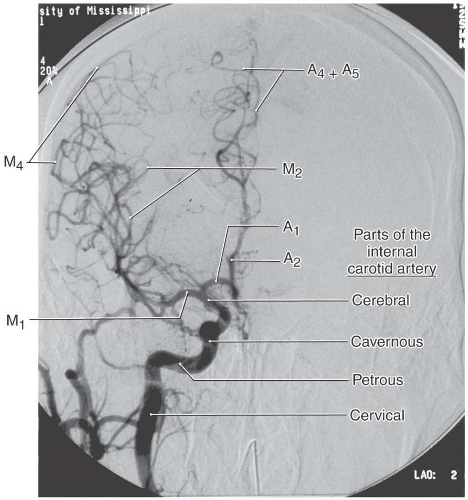 A Survey of the Cerebrovascular System | Neupsy Key