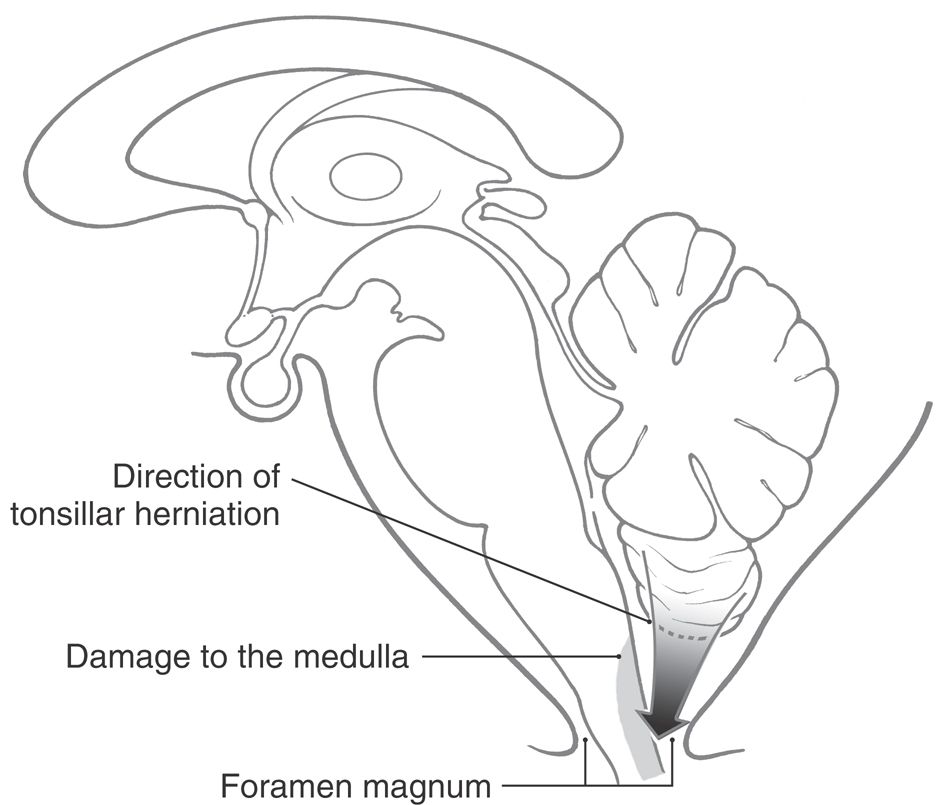 The Medulla Oblongata | Neupsy Key