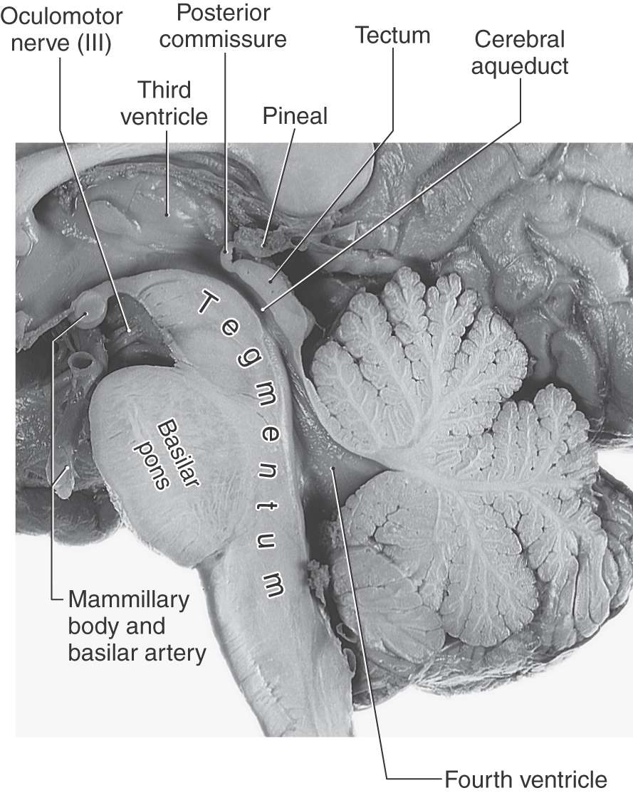 The Midbrain | Neupsy Key