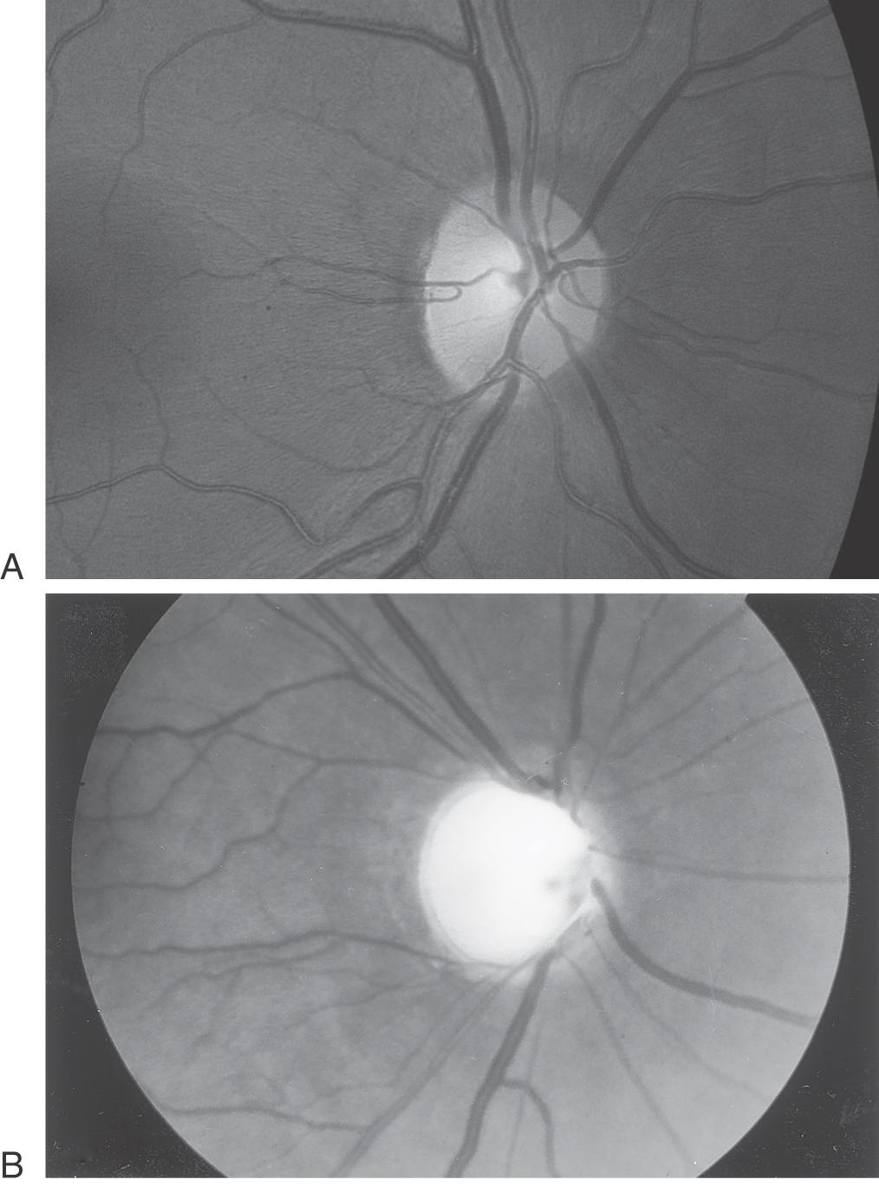 The Neurologic Examination | Neupsy Key