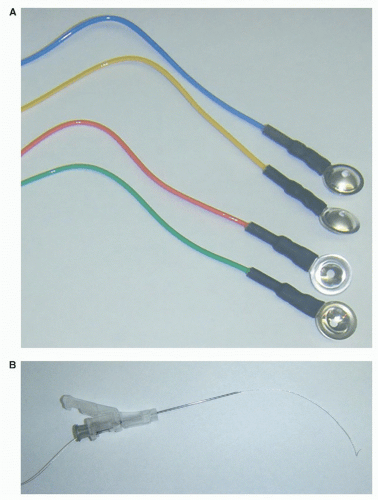 Video-EEG Monitoring and Epilepsy Surgery | Neupsy Key